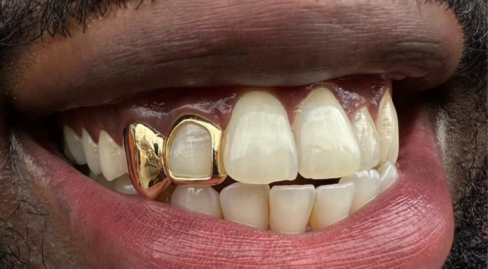 Discover the History of Grillz and Their Cultural Legacy